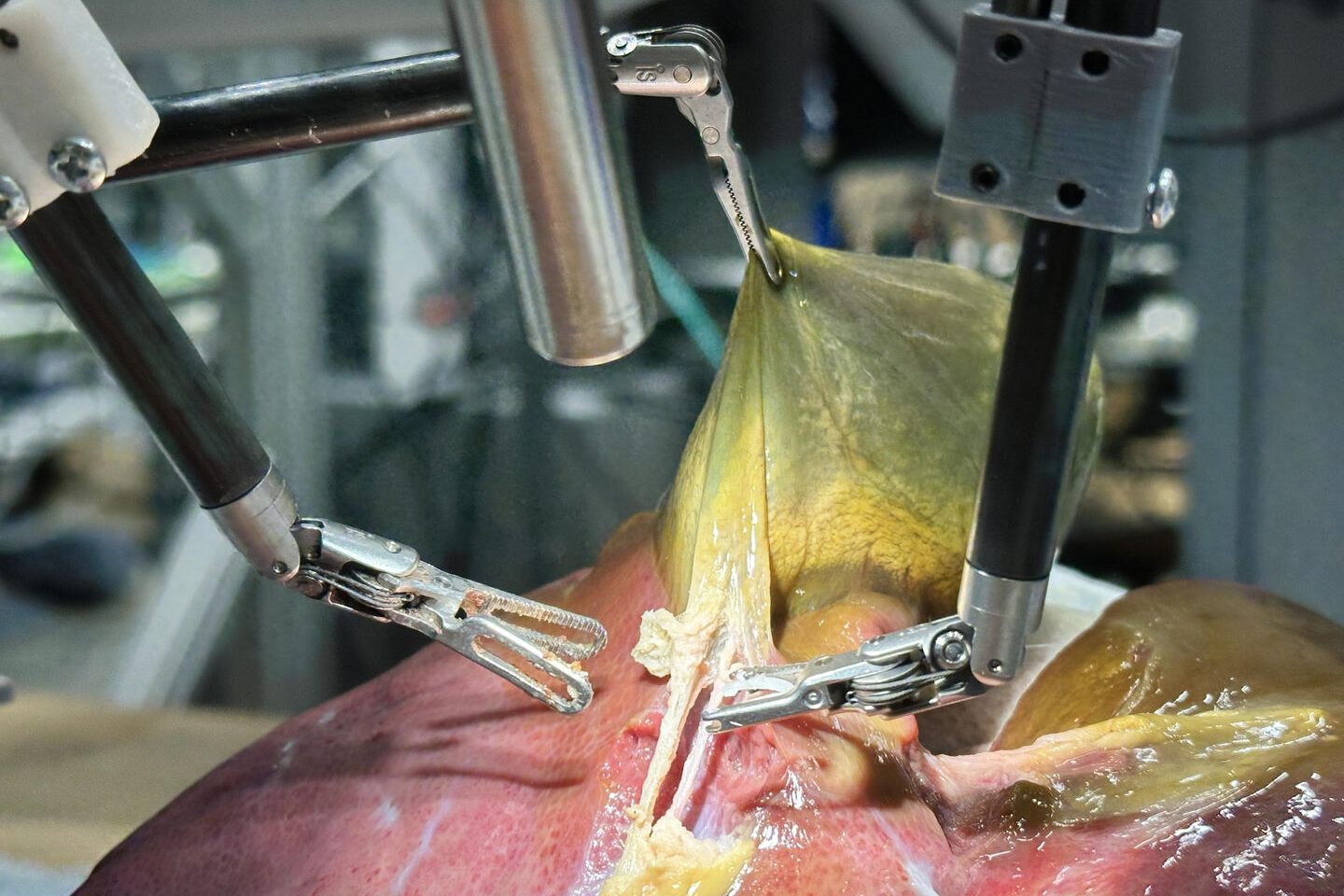 Robot performs first realistic surgery without human help - Data ...
